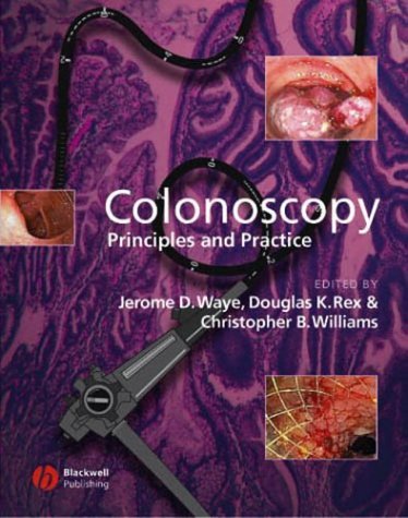 Colonoscopy: Principles and Practice by Jerome D. Wayne | Goodreads