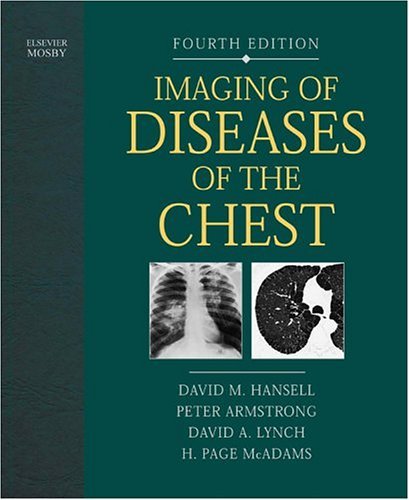 Imaging of Diseases of the Chest: Expert Consult - Online and Print by ...