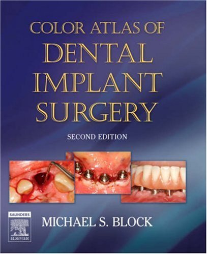 Color Atlas of Dental Implant Surgery by Michael S. Block | Goodreads