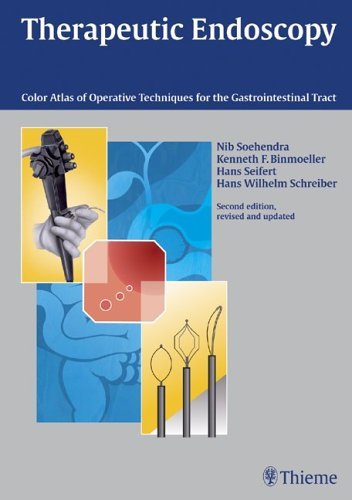 Therapeutic Endoscopy: Color Atlas Of Operative Techniques For The ...