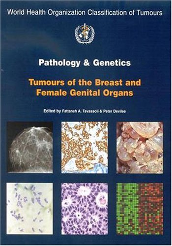 Pathology and Genetics of Tumours of the Breast and Female Genital ...