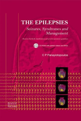 The Epilepsies: Seizures, Syndromes and Management by C.P ...