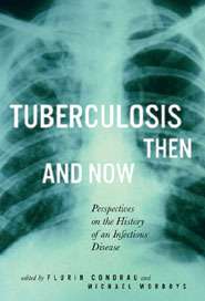 Tuberculosis Then and Now: Perspectives on the History of an Infectious ...