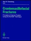 Craniomaxillofacial Fractures: Principles of Internal Fixation Using ...