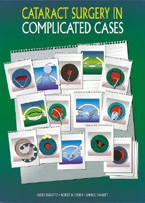 Cataract Surgery in Complicated Cases by Lucio Buratto MD | Goodreads