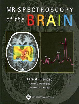 Mr Spectroscopy of the Brain by Lara A. Brandão | Goodreads