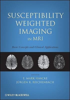 Susceptibility Weighted Imaging in MRI: Basic Concepts and Clinical ...