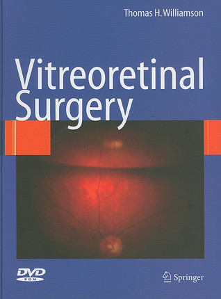 Vitreoretinal Surgery by Thomas H. Williamson | Goodreads
