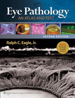 Eye Pathology: An Atlas and Text by Ralph C. Eagle Jr. | Goodreads