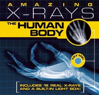 Amazing X-rays: The Human Body by Paul Beck | Goodreads