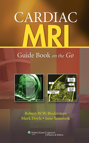 Cardiac MRI: Guide Book on the Go by Robert W. Biederman MD FACC FASA ...