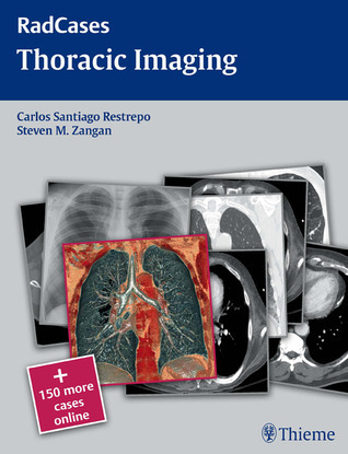 Radcases Thoracic Imaging by Carlos Santiago Restrepo | Goodreads