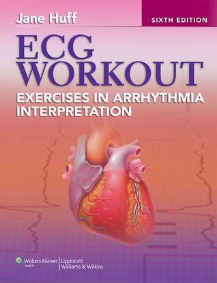 ECG Workout: Exercises in Arrhythmia Interpretation by Jane Huff ...