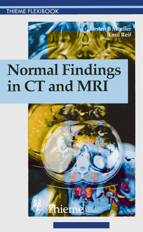 Normal Findings in Ct and Mri by Torsten B. Moeller | Goodreads