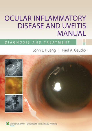Ocular Inflammatory Disease and Uveitis Manual: Diagnosis and Treatment ...