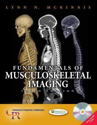 Fundamentals of Musculoskeletal Imaging by Lynn N. McKinnis PT DPT OCS ...