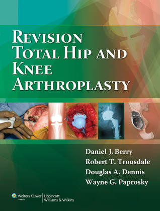 Revision Total Hip and Knee Arthroplasty by Daniel J. Berry | Goodreads