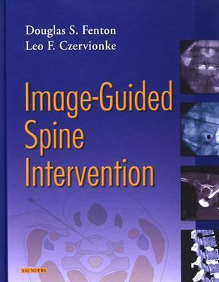 Image-Guided Spine Intervention by Douglas S. Fenton | Goodreads