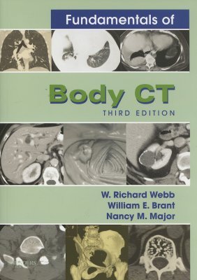 Fundamentals of Body Ct (3rd Edition) by W. Richard Webb MD | Goodreads