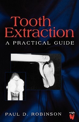 Tooth Extraction: A Practical Guide by Paul D. Robinson | Goodreads