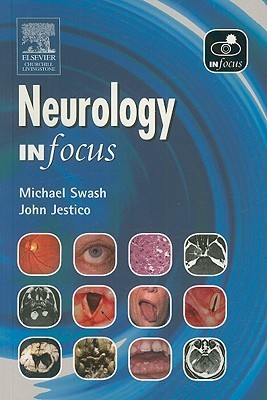 Neurology In Focus by Michael Swash MD FRCP MRCPath | Goodreads