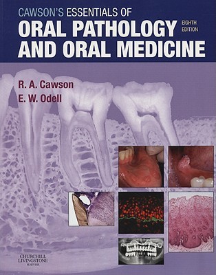Cawson's Essentials of Oral Pathology and Oral Medicine by Roderick A. Cawson | Goodreads