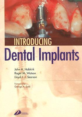 Introducing Dental Implants by John A. Hobkirk | Goodreads