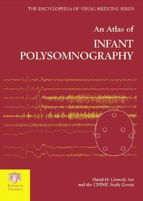 An Atlas of Infant Polysomnography by David H. Crowell | Goodreads