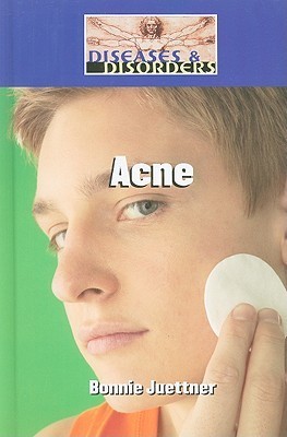 Acne (Diseases and Disorders) by Bonnie Juettner | Goodreads