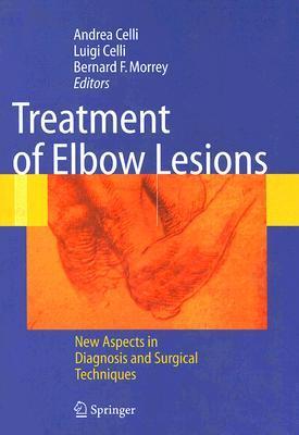 Treatment of Elbow Lesions: New Aspects in Diagnosis and Surgical ...