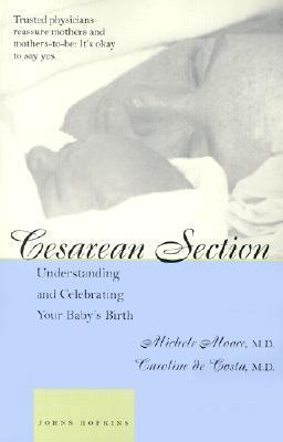 Cesarean Section: Understanding and Celebrating Your Baby's Birth by ...