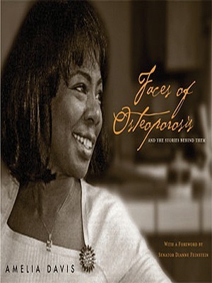 Faces of Osteoporosis: And the Stories Behind Them by Amelia Davis ...