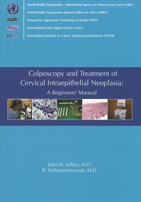 Colposcopy and Treatment of Cervical Intraepithelial Neoplasia: A ...