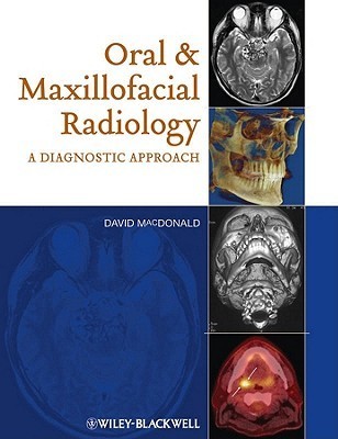 Oral and Maxillofacial Radiology: A Diagnostic Approach by David ...