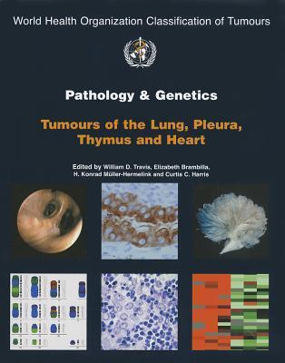 Pathology and Genetics of Tumours of the Lung, Pleura, Thymus and Heart ...