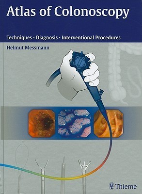 Atlas of Colonoscopy: Techniques, Diagnosis, Interventional Procedures ...