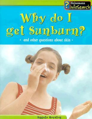 Why Do I Get Sunburn?: And Other Questions About Skin by Angela Royston ...