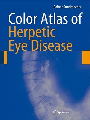 Color Atlas of Herpetic Eye Disease: A Practical Guide to Clinical ...