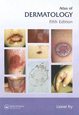 Atlas of Dermatology, Fifth Edition by Lionel Fry | Goodreads