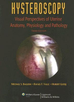 Hysteroscopy: Visual Perspectives of Uterine Anatomy, Physiology and ...