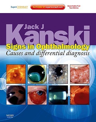 Signs in Ophthalmology: Causes and Differential Diagnosis: Expert ...