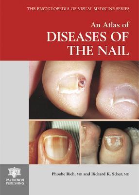 An Atlas of Diseases of the Nail by Phoebe Rich | Goodreads