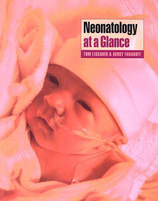 Neonatology at a Glance by Tom Lissauer | Goodreads