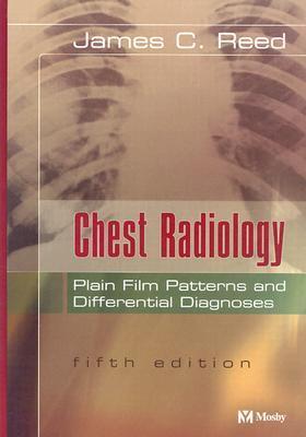 Chest Radiology -- Plain Film Patterns and Differential Diagnoses by ...
