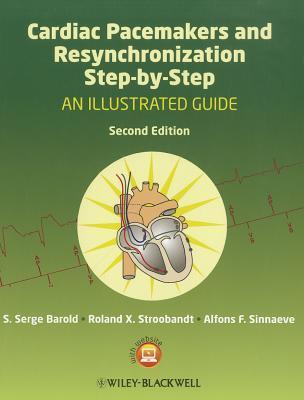 Cardiac Pacemakers and Resynchronization Step by Step: An Illustrated ...