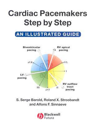 Cardiac Pacemakers Step-by-Step: An Illustrated Guide by S. Serge ...