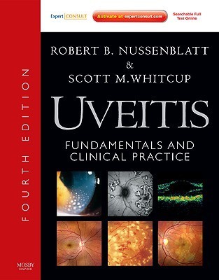Uveitis: Fundamentals and Clinical Practice: Expert Consult - Online ...