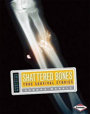Shattered Bones: True Survival Stories by Sandra Markle | Goodreads