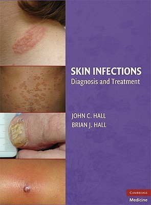 Skin Infections: Diagnosis and Treatment by John C. Hall | Goodreads