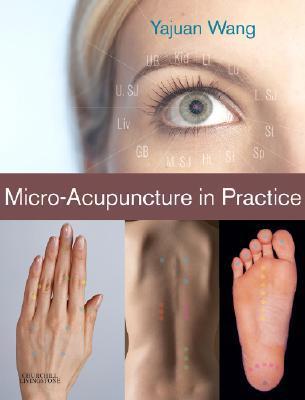 Micro-Acupuncture in Practice by Yajuan Wang | Goodreads